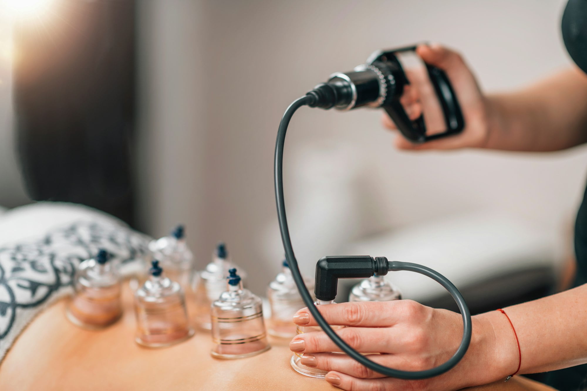 Cupping | Zhong Hua Medical